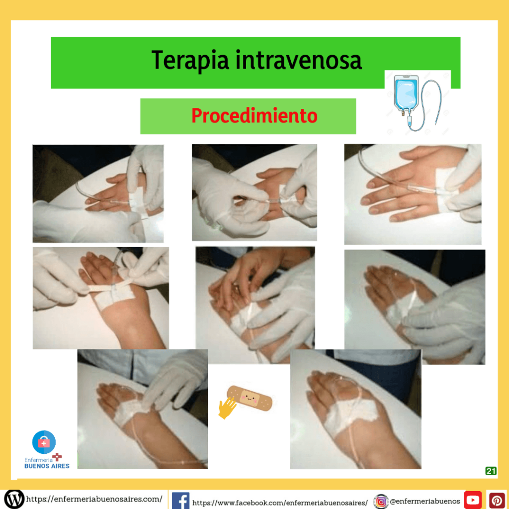 Procedimiento sobre Terapia Intravenosa - Infografias completas 2020 Procedimiento sobre Terapia Intravenosa - Infografias completas 2020